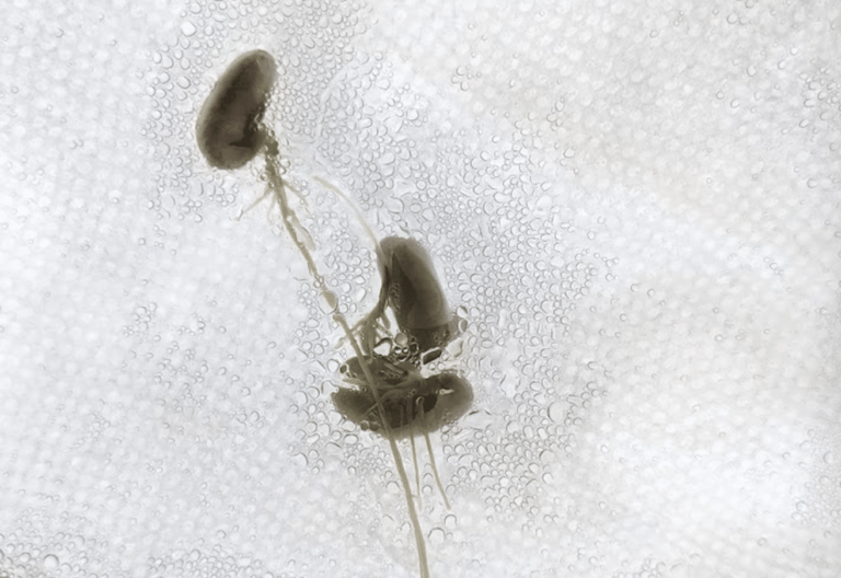 How To Grow Beans In A Bag - Bean in a Bag Science Experiment for Kids ...